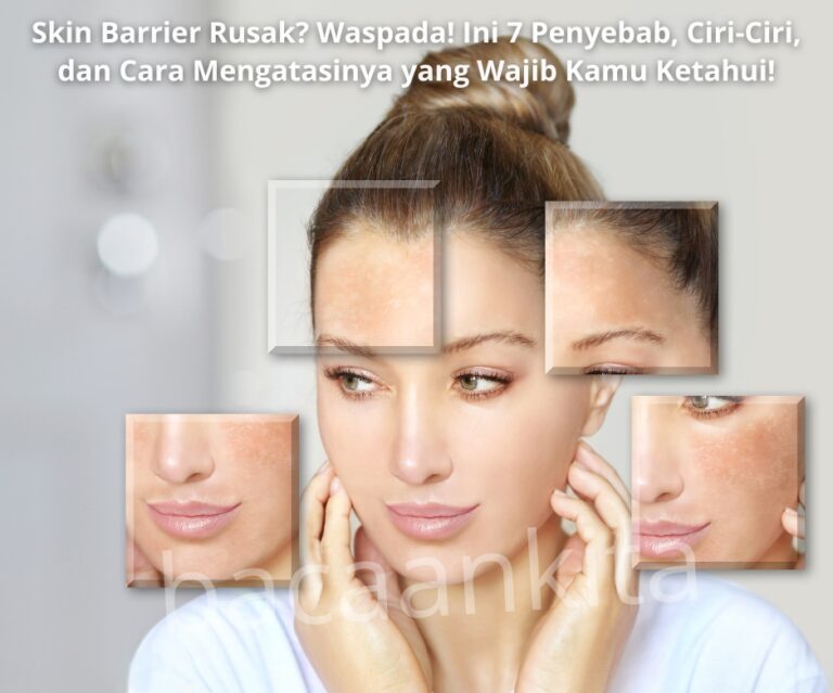 Skin Barrier Rusak? Waspada! Ini 7 Penyebab, Ciri-Ciri, dan Cara ...